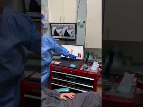 Dental Assistant Training Day #sanfrancisco #fremont #oakland #sanjose #dental #dentalassistant