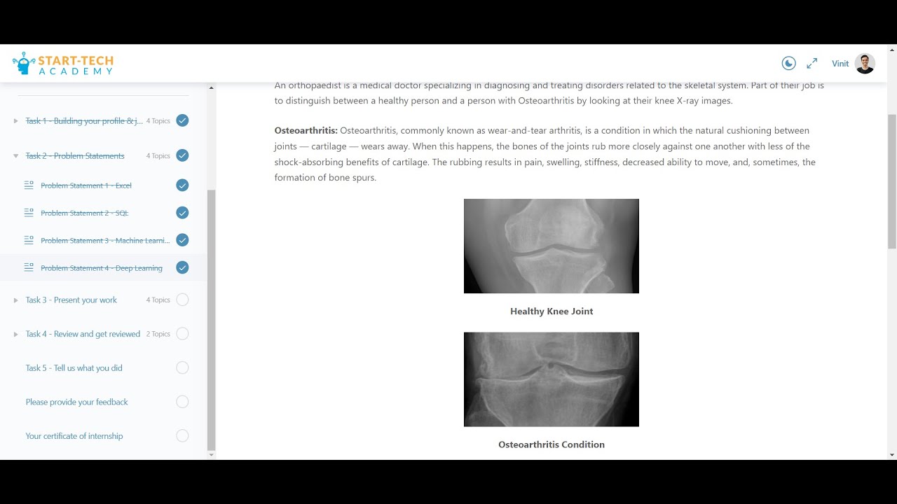 Start-Tech Academy iStep Program Task4: Osteoarthritis detection using Deep Learning