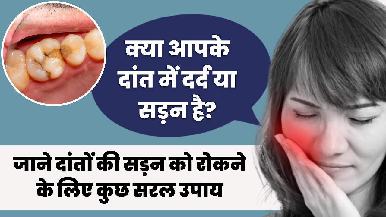How to Prevent Tooth Decay Proven Ways to Keep Your Teeth Decay Free l Tooth Decay Prevention