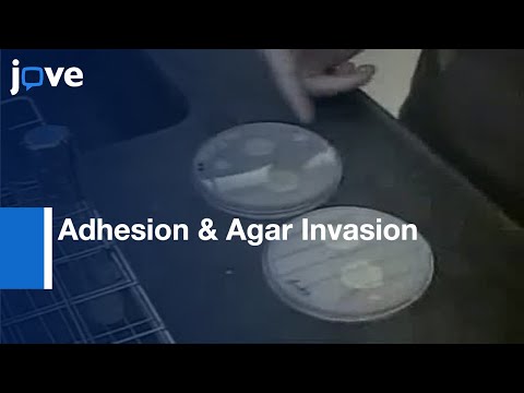 Assay: Adhesion & Agar Invasion In S. cerevisiae l Protocol Preview