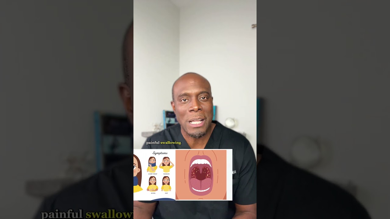 Strep Throat: How Contagious Is It?