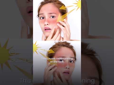 🌞 Do you ever notice that your face is darker than the rest of your body? 🤔 || Dr Jushya Sarin ||