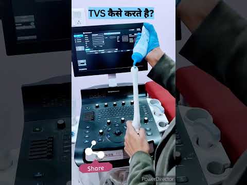 TVS#transvaginal sonography #ultrasound #gynecologist #gyne #doctorslife