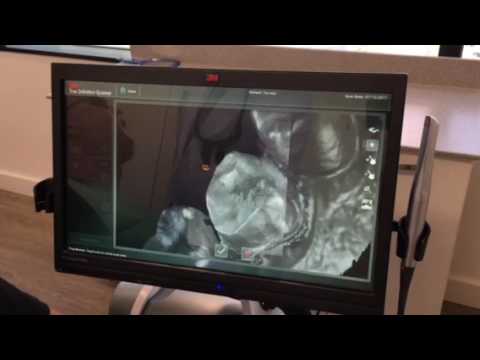 3M True Definition Scanner