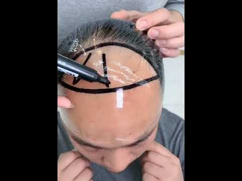 fix your bald patch easily 👍