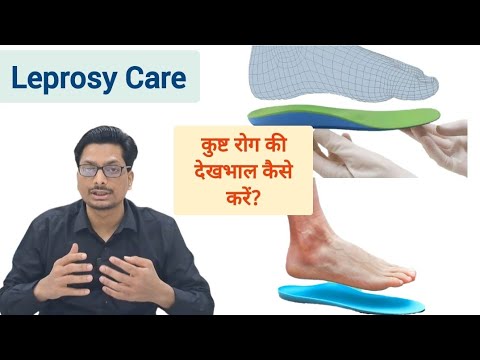 Leprosy Care | कुष्ट रोग की देखभाल | leprosy disease in hindi | kust rog ki dawa | kust rog kya hai