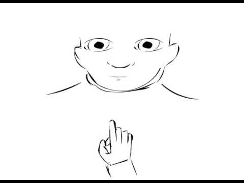 Congenital Oculomotor Apraxia