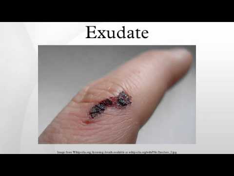 Exudate