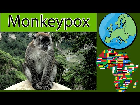 Monkeypox Explained under 3 minutes. Everyhing you should know about Mankeypox virus.