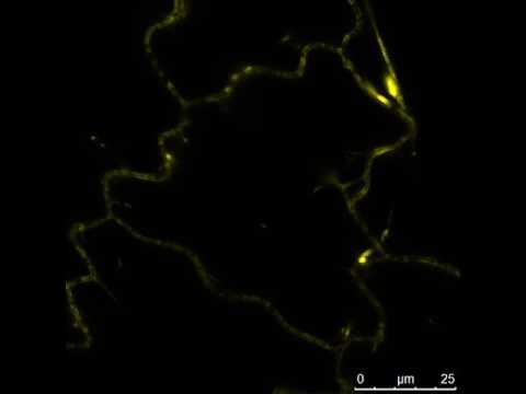 Reticulum endoplasmic transversale ( microcope confocal )
