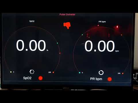 Raspberry Pi 400 Pulse Oximeter displaying full screen on TV Monitor
