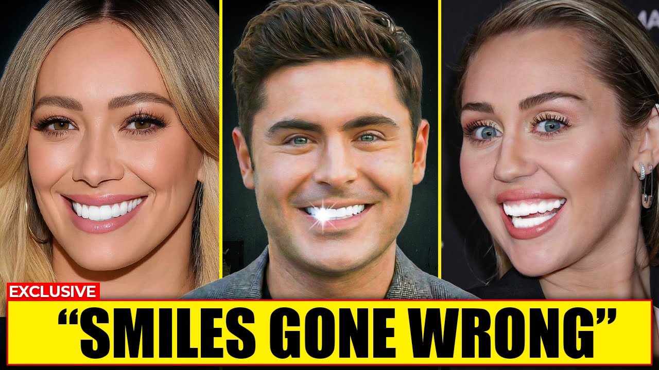 15 Celebrities Who RUINED Their Smiles With Veneers