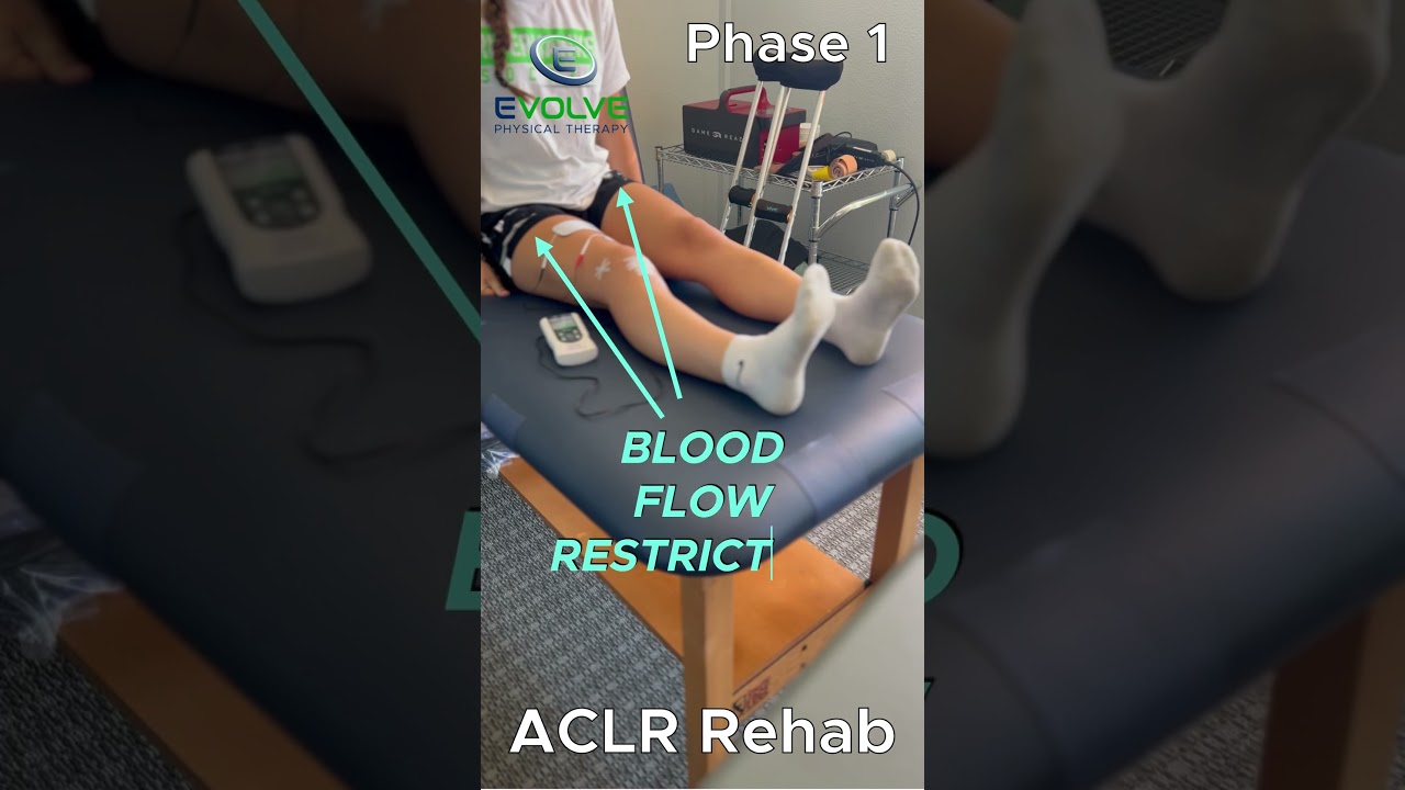 3 Crucial Exercises in Early ACL Rehab: Mastering Quadriceps Strength | Pediatric ACL Recovery