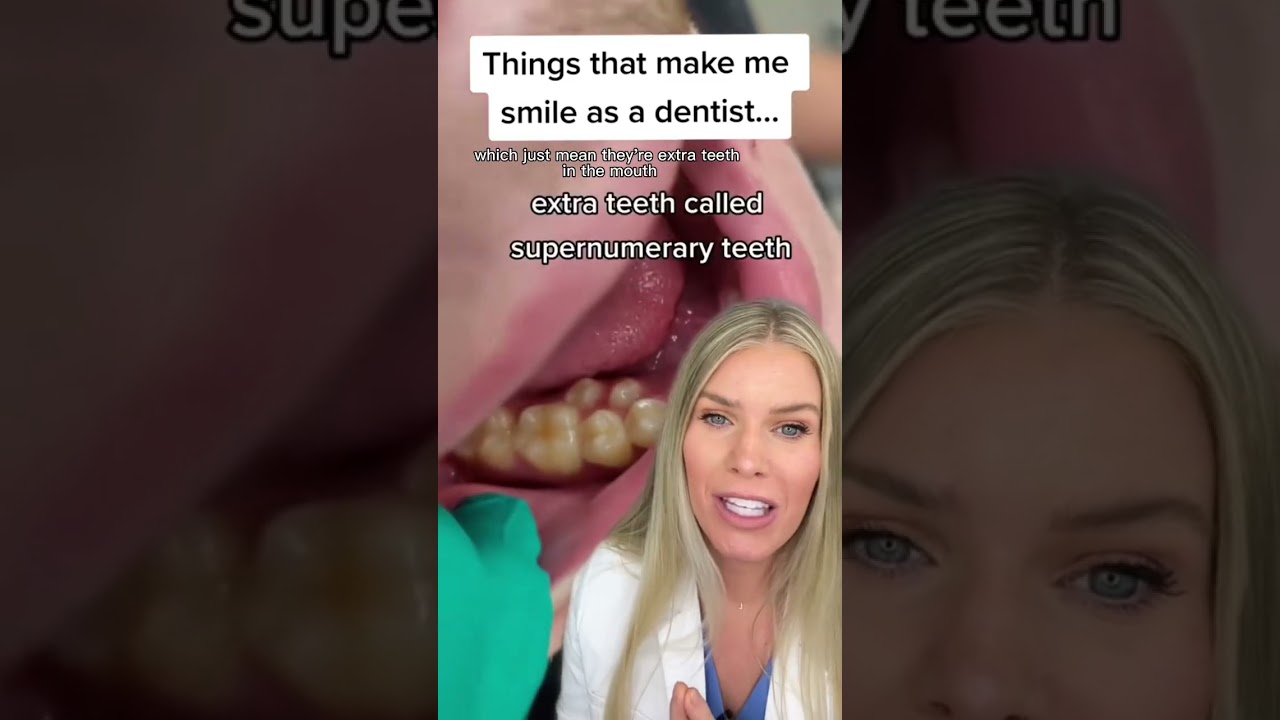 Do you have extra teeth? It happens! #extrateeth #bonusteeth #wisdomteeth #dentist