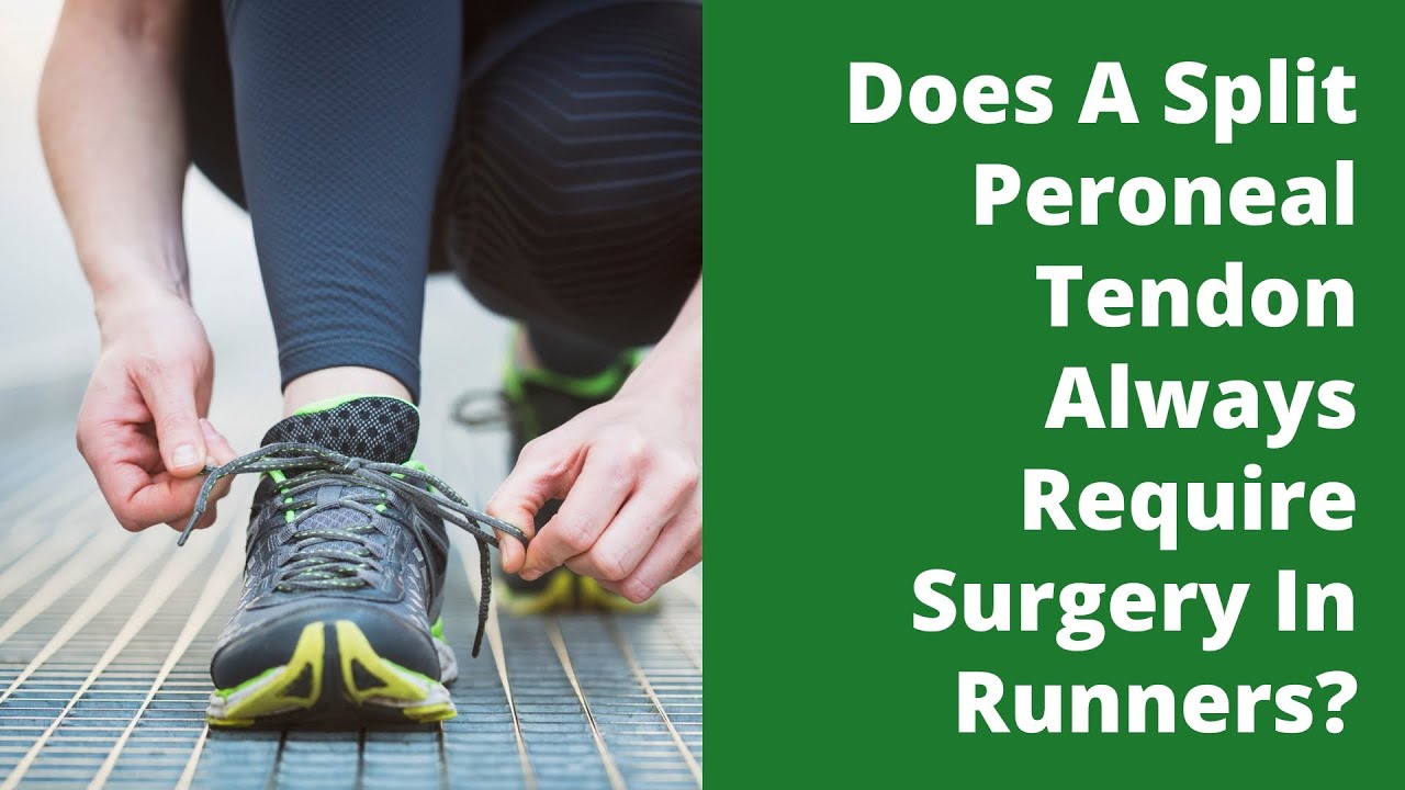 Does A Split Peroneal Tendon Always Require Surgery In Runners?