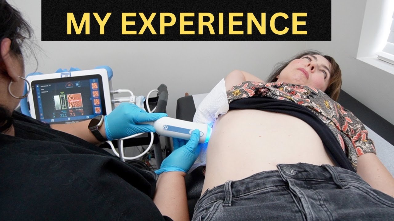 Watch this BEFORE You Get a Fibroscan (Liver Scan)