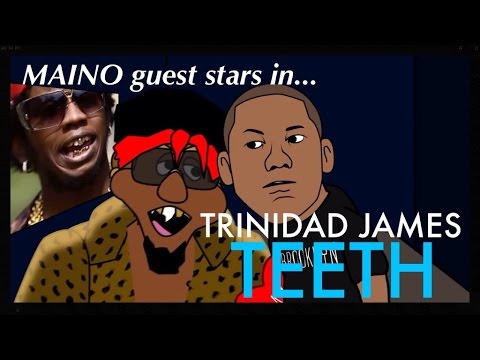 HILARIOUS: Trinidad James Teeth | digibuzzmusic