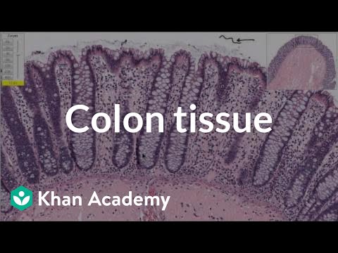 Tecido do cólon normal (vídeo) | Khan Academy