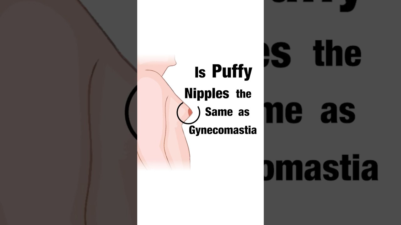 Are Puffy Nipples The Same As Gynecomastia? Dr. Aniketh Venkataram, The Venkat Center, Bengaluru