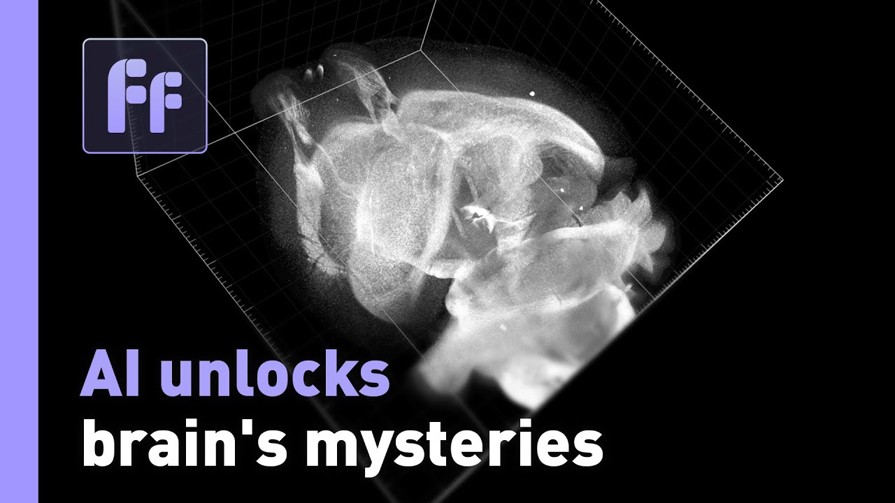 AI helps Johns Hopkins brain lab to unlock neuroscience mysteries