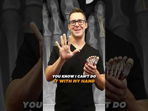 Why are My Toes SEPARATING? [ Causes, Symptoms]