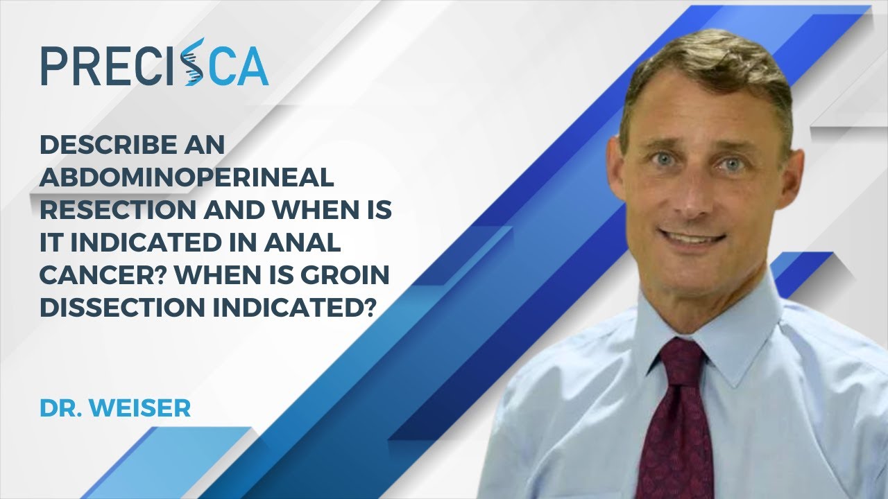 When is an abdominoperineal resection indicated in anal cancer? When is groin dissection indicated?