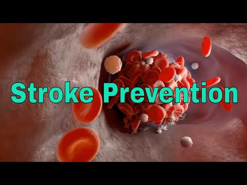 The Stroke Prevention Diet: 10 Foods You Need! #strokeawareness