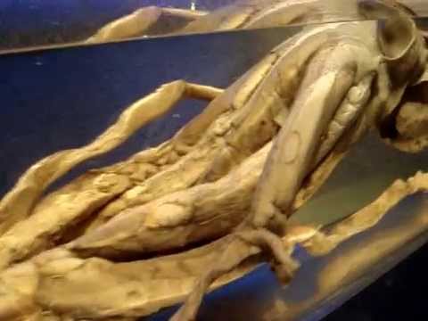 Calamar gigante.
