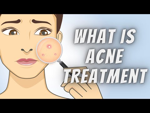 What Is Acne And How To Get Rid Of It | What is Acne Treatment | Acne Treatment | Facial Acne