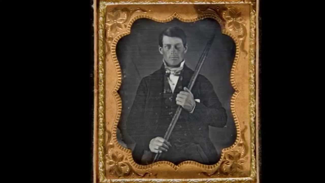 The Remarkable Story of Phineas Gage: A Journey Through Brain Injury ...