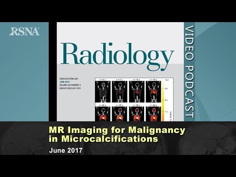 MR Imaging for Malignancy in Microcalcifications (June 2017)