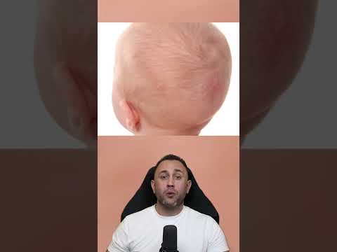 What Your Birthmark Says About Your Past Life #shorts