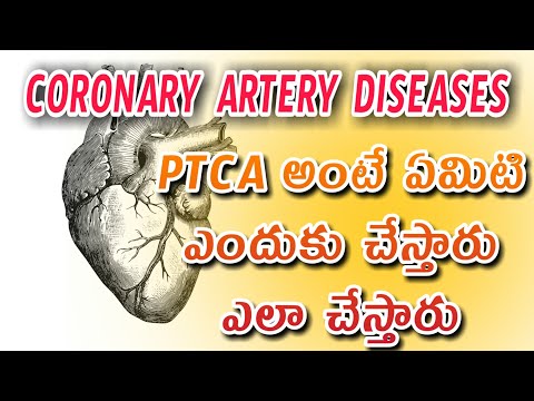 [ PTCA ] Percutaneous transluminal coronary angioplasty  EXPLAINED IN TELUGU