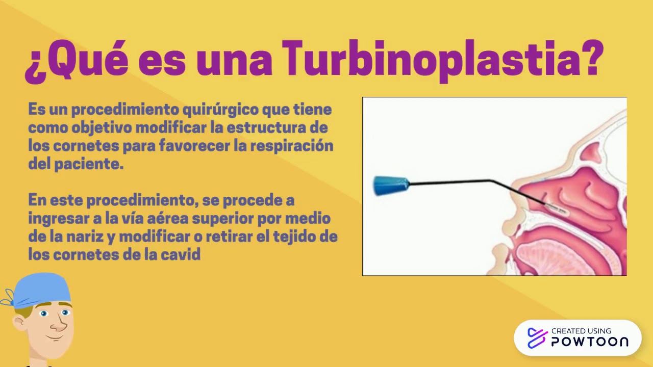 Turbinoplastia