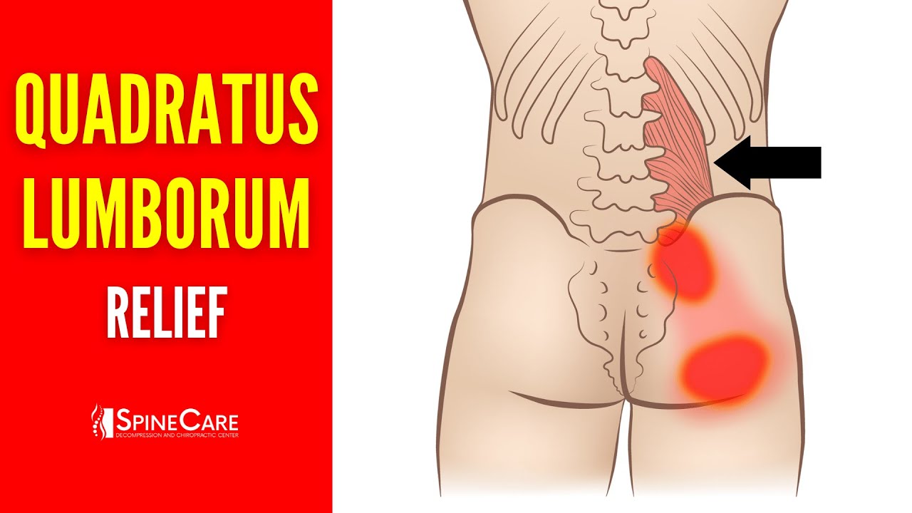 How to INSTANTLY Relieve Quadratus Lumborum Pain