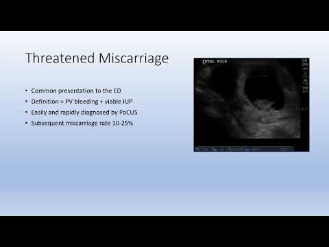 PV Bleeding in Early Pregnancy & Threatened Miscarriage