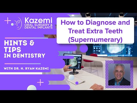 How to Diagnose and Treat Extra Teeth (Supernumerary)