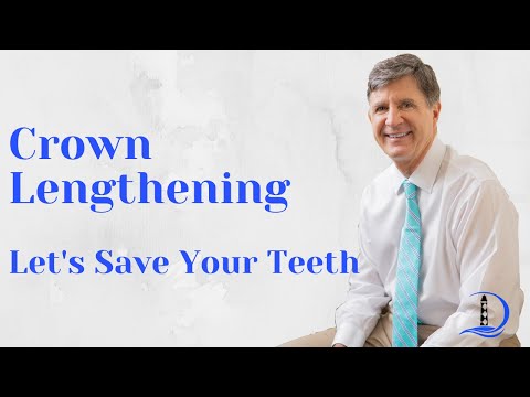 CROWN LENGTHENING EXPLAINED: SAVE YOUR TOOTH WITH THIS PROCEDURE! 🦷✨🔍