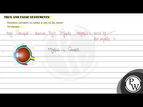 TRUE AND FALSE STATEMENIS Excessive curvature in cornea is one of the reason for myopia.