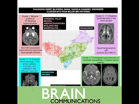 Magnetic resonance imaging pattern recognition in childhood bilateral basal ganglia disorders
