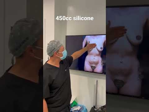 450 cc boob job