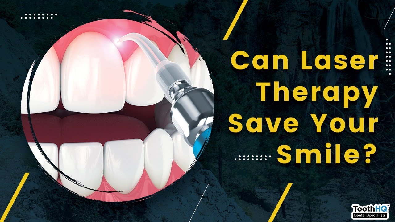 🔍 Stage 2 Periodontitis: Can Laser Therapy Save Your Smile? 🚀