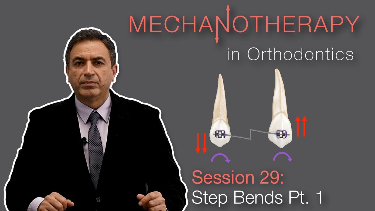 Mechanotherapy in Orthodontics: Step Bends Pt. 1