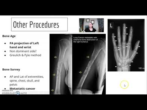 ARRT procedures part #10 Humerus & Shoulder