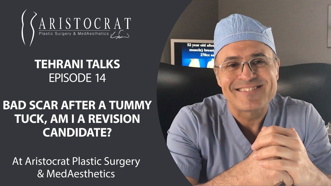 Tehrani Talks Episode 14: Tummy Tuck Scar Revision