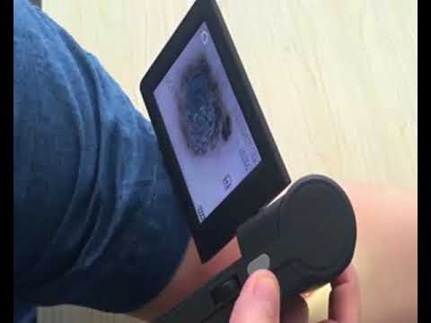 Portable Digital Microscope Dermatoscope ---operation video