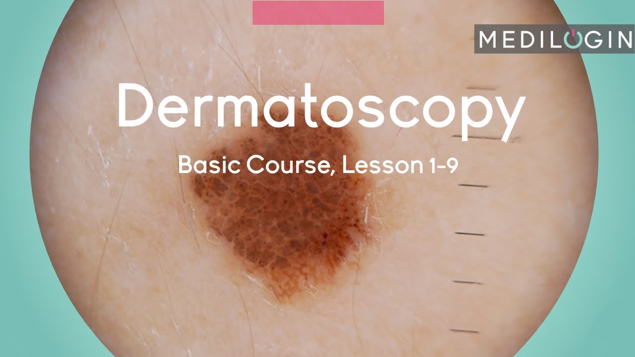 Dermoscopy (Dermoscopy Basics) | MEDILOGIN