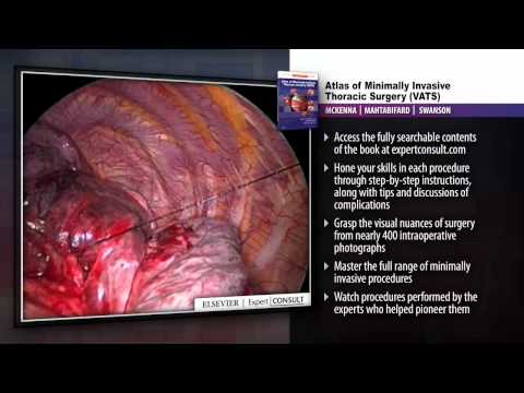 Atlas of Minimally Invasive Thoracic Surgery (VATS)