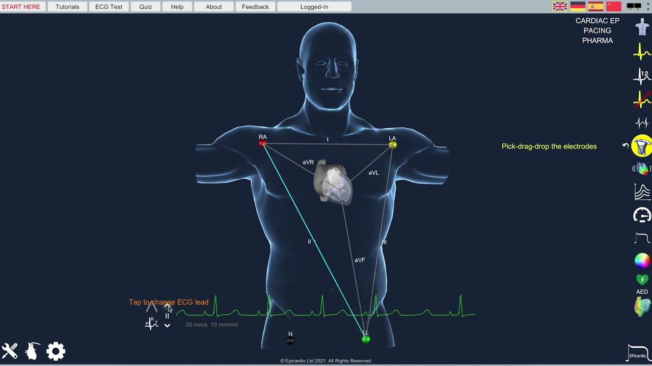 Epicardio Simulation Brief Introduction
