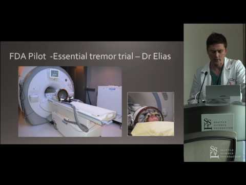 MRI Guided Focused Ultrasound in Neurosurgery by Stephen Monteith, M.D.